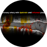 KAIST MECHANICAL ENGINEERING